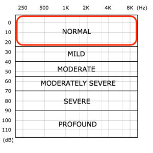Audiogram?-How To Read a Hearing Test - Pro Fit Hearing